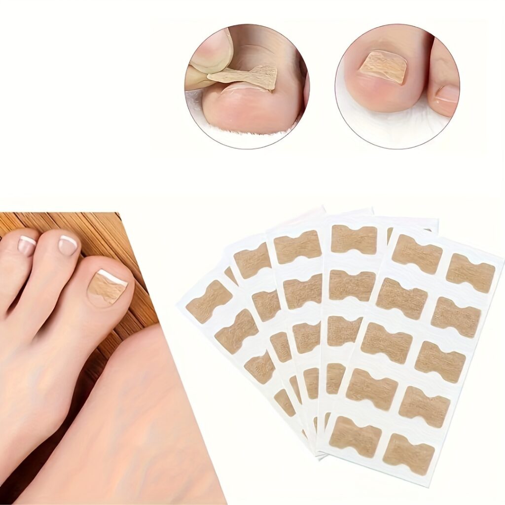 100pcs Ingrown Toenail Corrector Pads Gluefree Nail Patches For ...